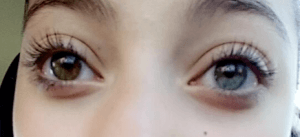 DNA and Heterochromia: Two Different-Colored Eyes! - HomeDNA Paternity