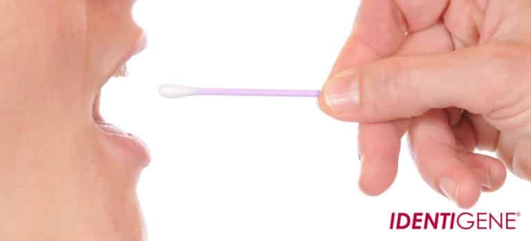 DNA Paternity Testing Samples: Blood, Spit, or Cheek Swabs? - HomeDNA ...